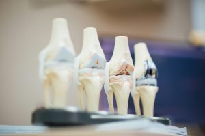 Common Joint Injuries - Causes, Symptoms & Treatments