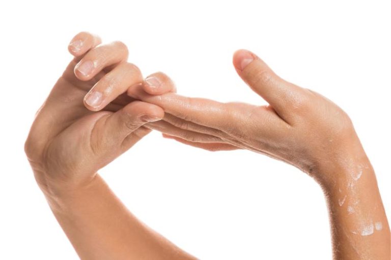 Physical Therapy For Hand Injuries Exercises And Recovery